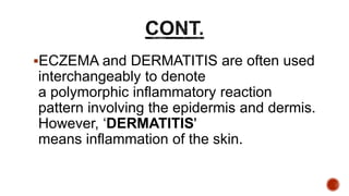Eczema (The Itch that rashes) | PPTX