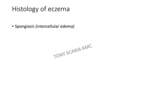Eczema and dermatitis DERMATOLOGY | PDF