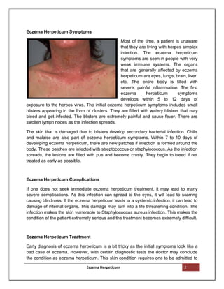 Eczema herpeticum | PDF | Infectious Diseases | Diseases and Conditions