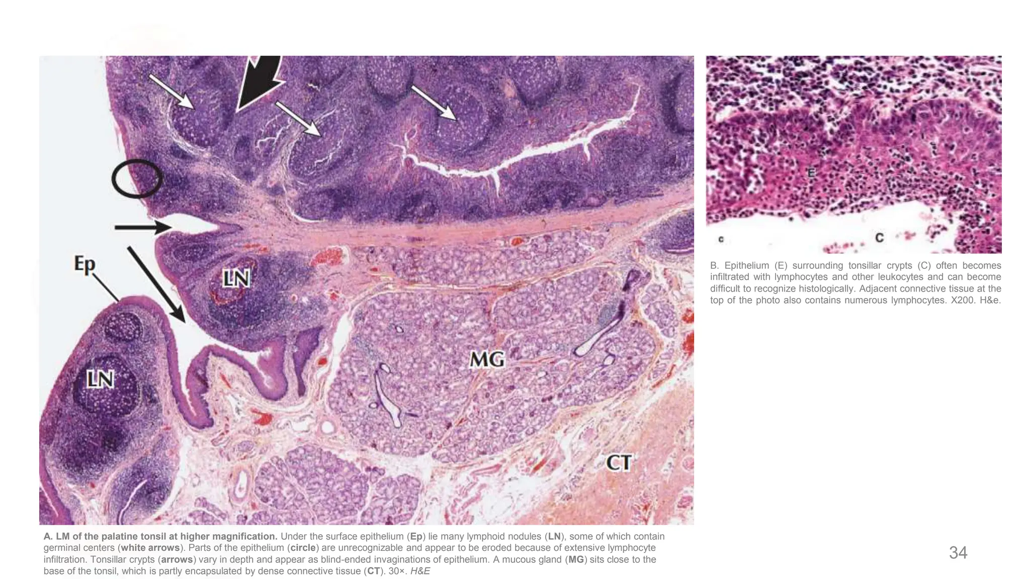 ~Thymus.&.Tonsils.Comprehensive.Histology.Jun.2022