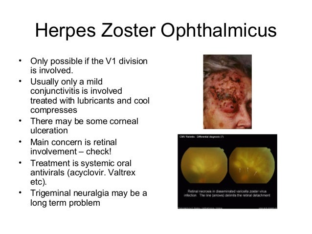 Opthalmology in the ED - Dr Andrew White (June 2013)