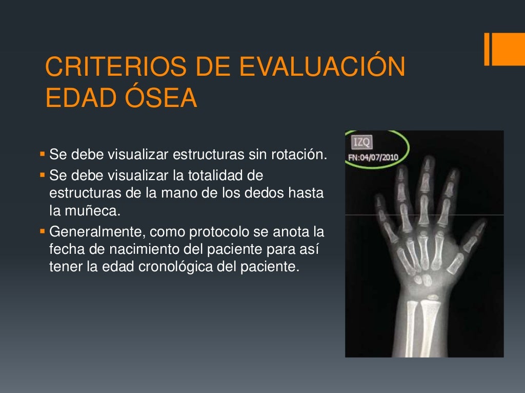 Edad ósea