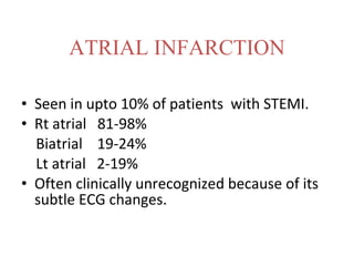 ECG: Atrial Infarct | PPT