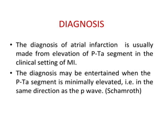 ECG: Atrial Infarct | PPT