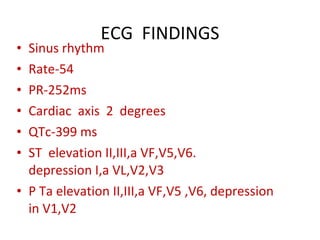 ECG: Atrial Infarct | PPT
