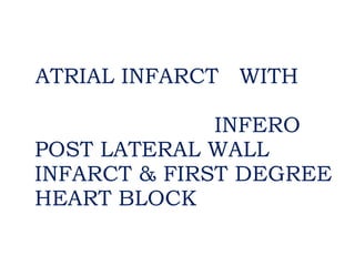 ECG: Atrial Infarct | PPT