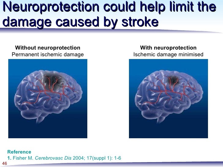 Neuroprotection In Acute Ischemic Stroke Download FTY720 Ameliorates