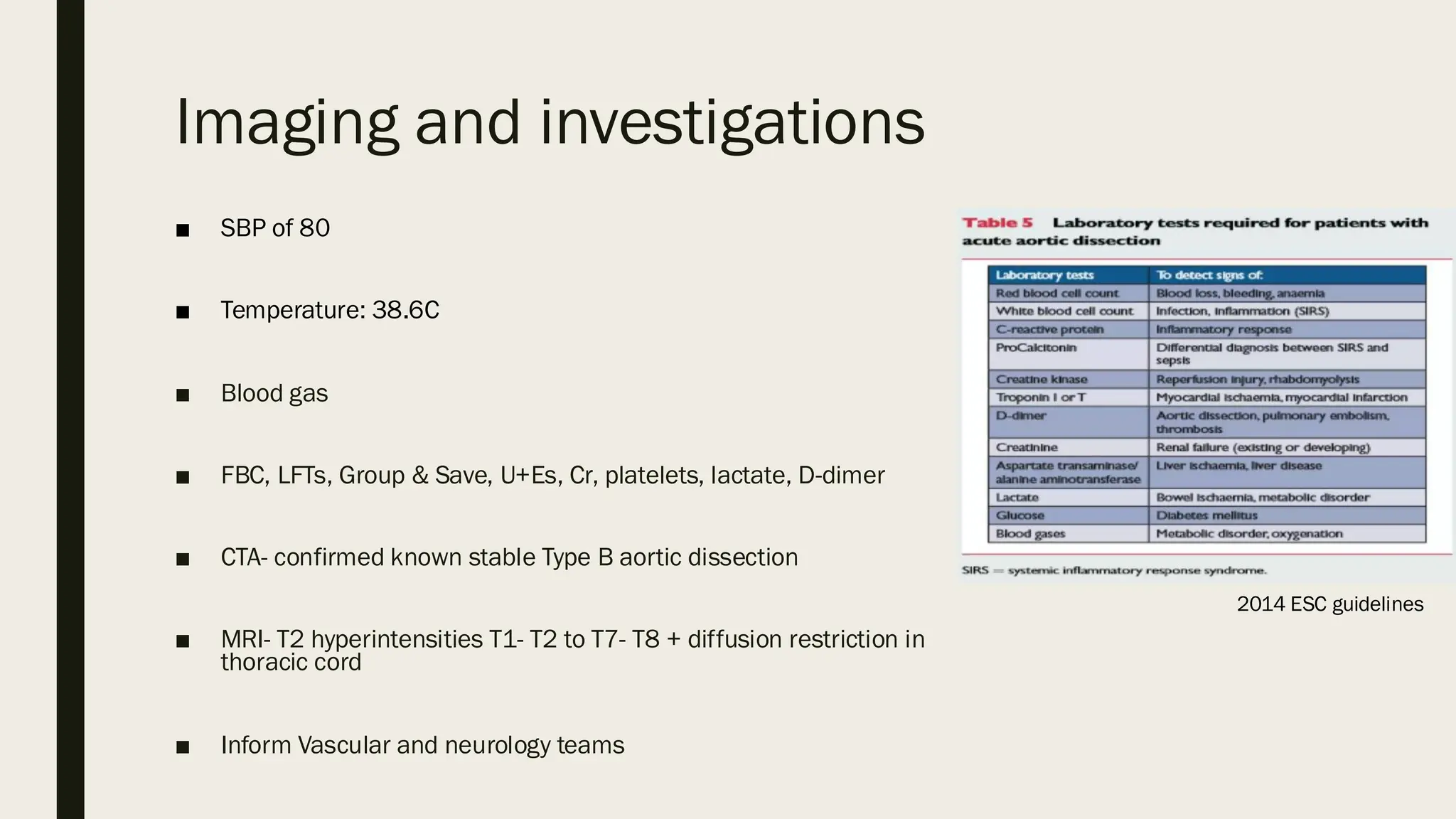 Type B aortic dissection + spinal cord infarction.pdf