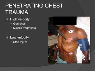 Blunt Chest Trauma