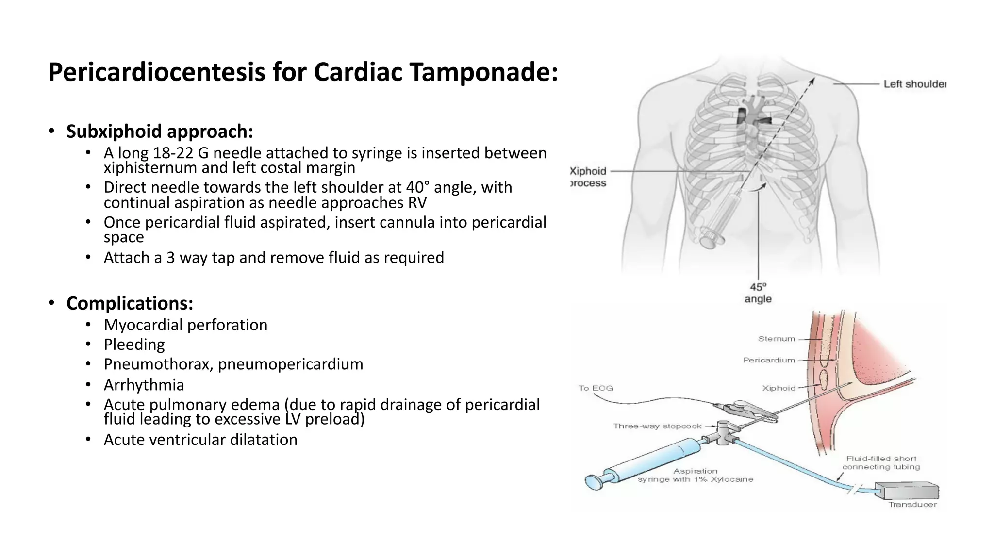Approach to chest pain | PDF