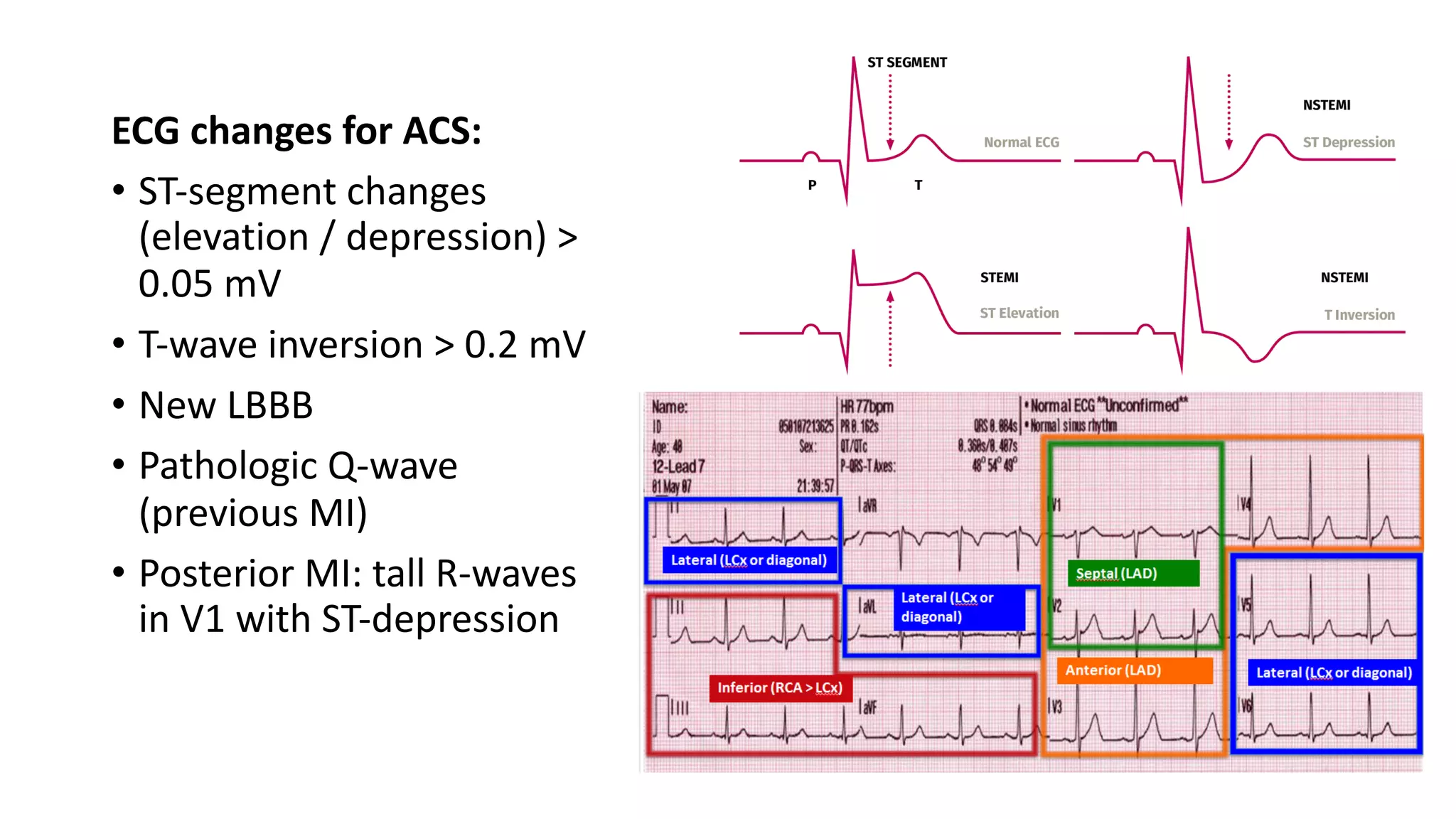 Approach to chest pain | PDF