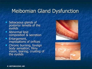 Ed&cornea lecture fatima | PPT