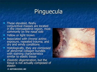 Ed&cornea lecture fatima | PPT