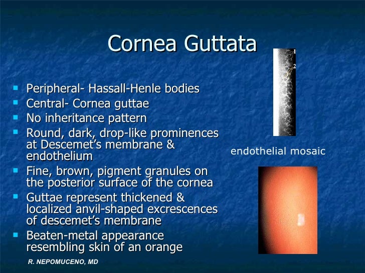 Ed&cornea lecture fatima