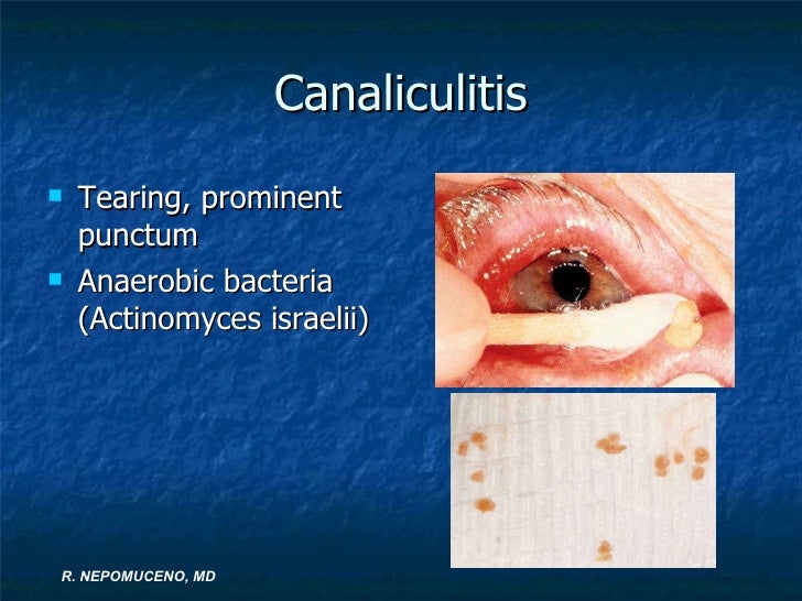 Ed&cornea lecture fatima