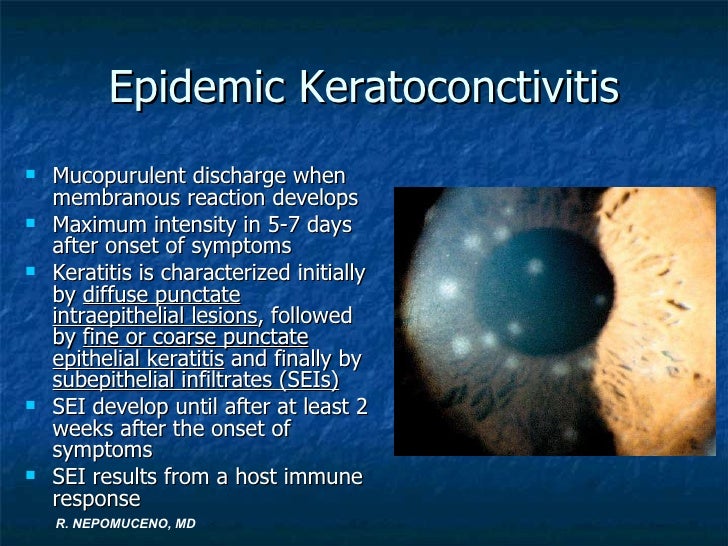 Ed&cornea lecture fatima