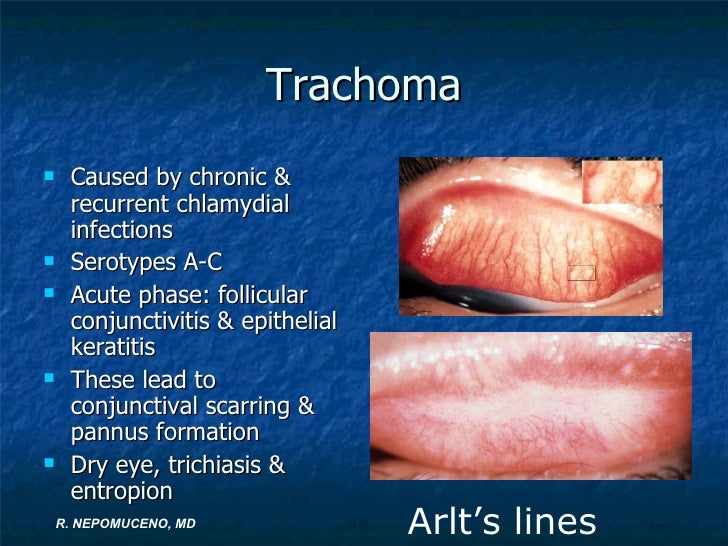 Ed&cornea lecture fatima