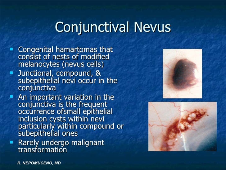 Ed&cornea lecture fatima