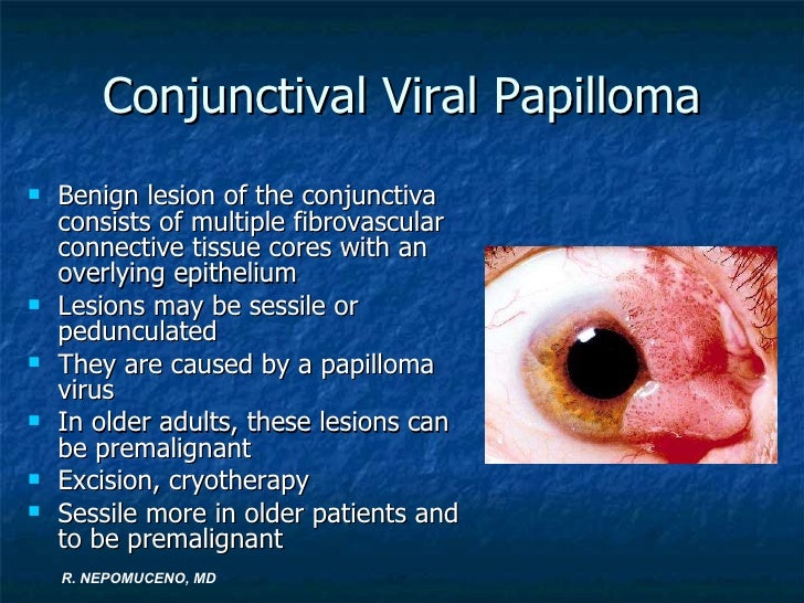Ed&cornea lecture fatima