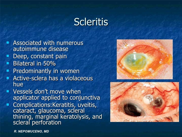 Ed&cornea lecture fatima