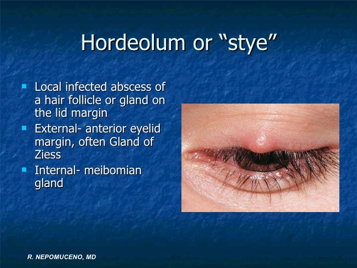 Ed&cornea lecture fatima