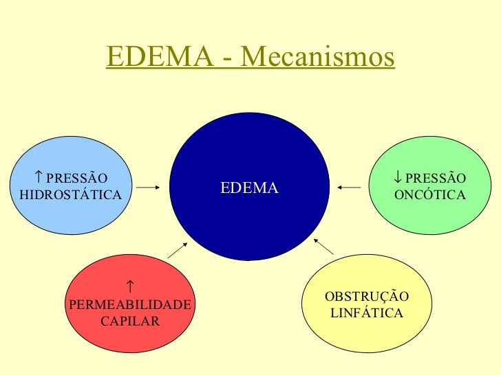 Edema