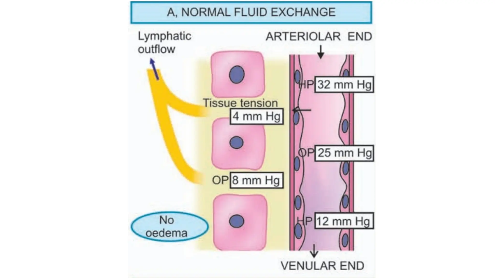 Edema ppt (definition , types of edema and more).pptx