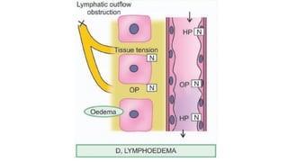 Edema ppt (definition , types of edema and more).pptx