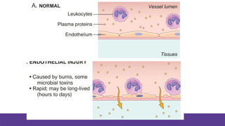 Edema ppt (definition , types of edema and more).pptx