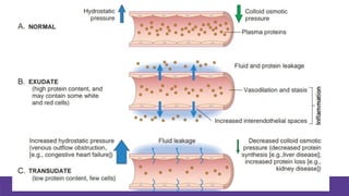 Edema ppt (definition , types of edema and more).pptx