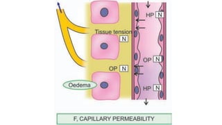 Edema complete details ppt (definition, types).pptx