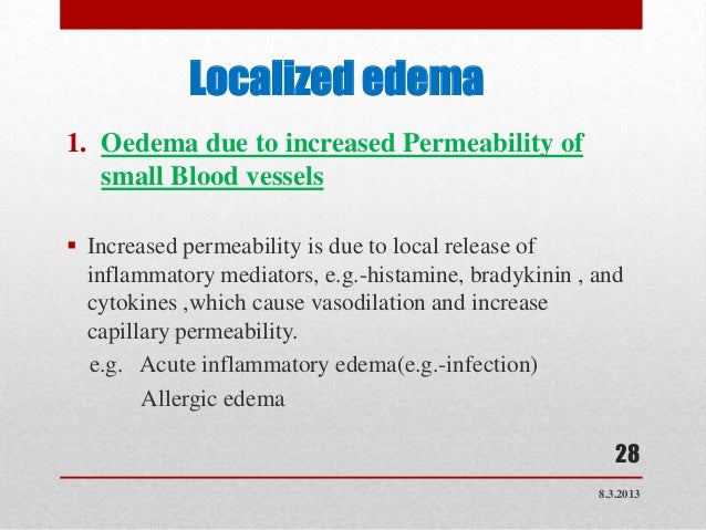 Edema
