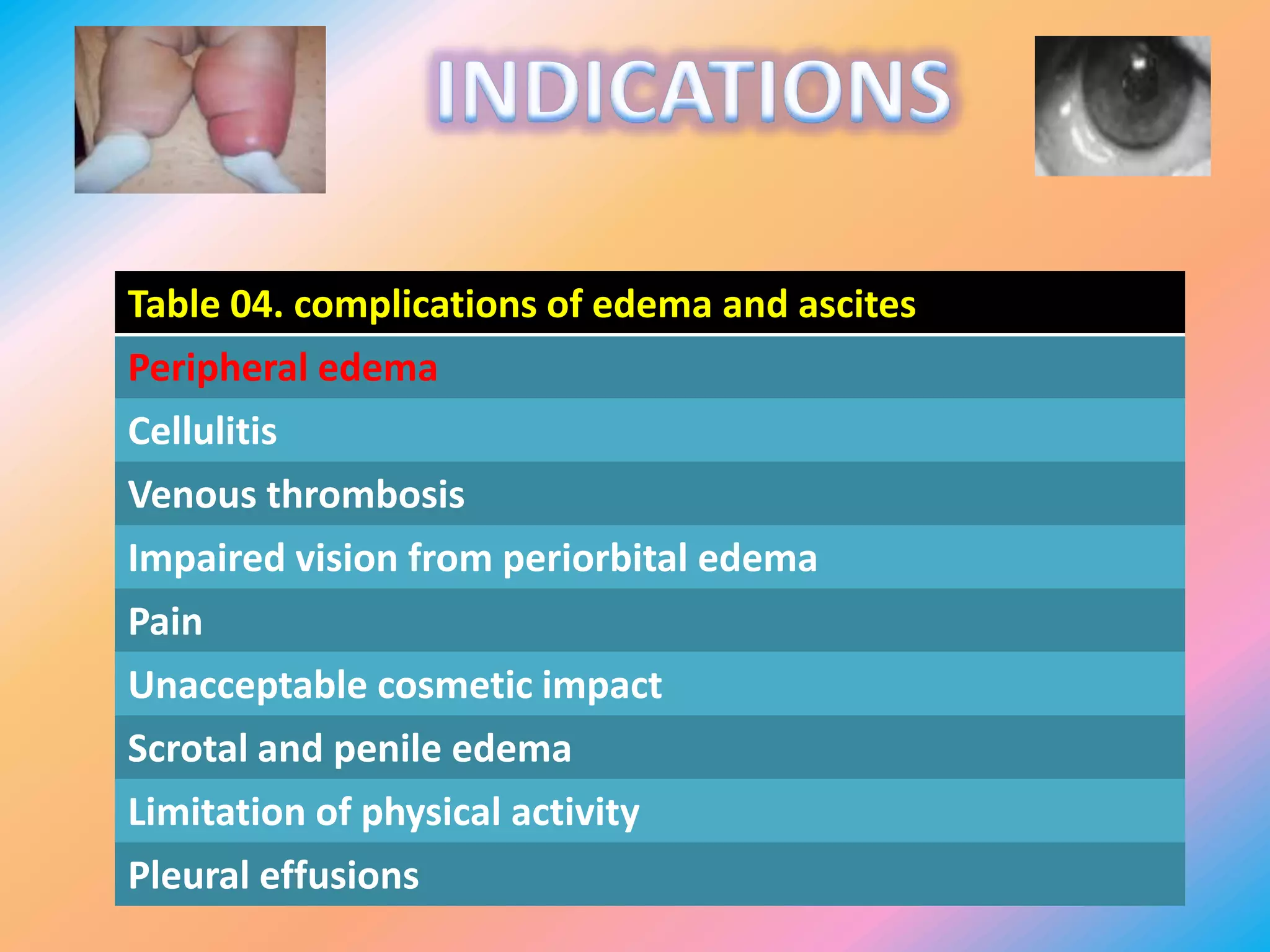 Edema | PPT