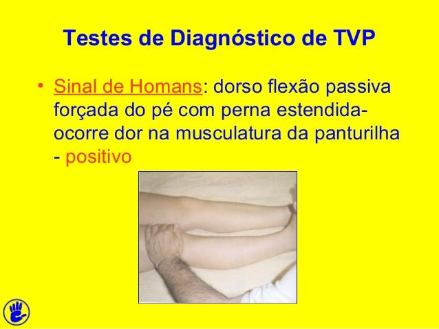 Edema - tipos e exemplos