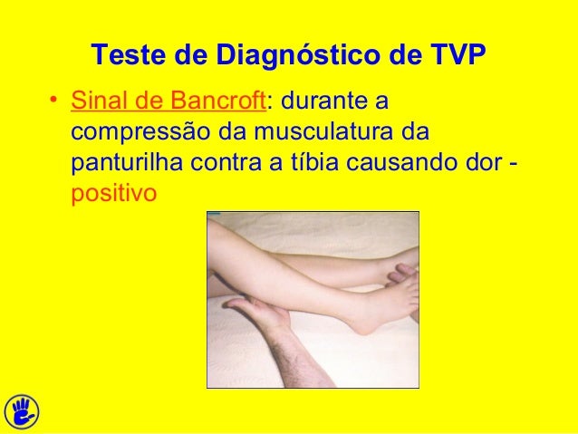 Edema - tipos e exemplos