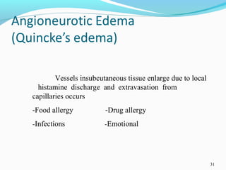 Edema | PPT