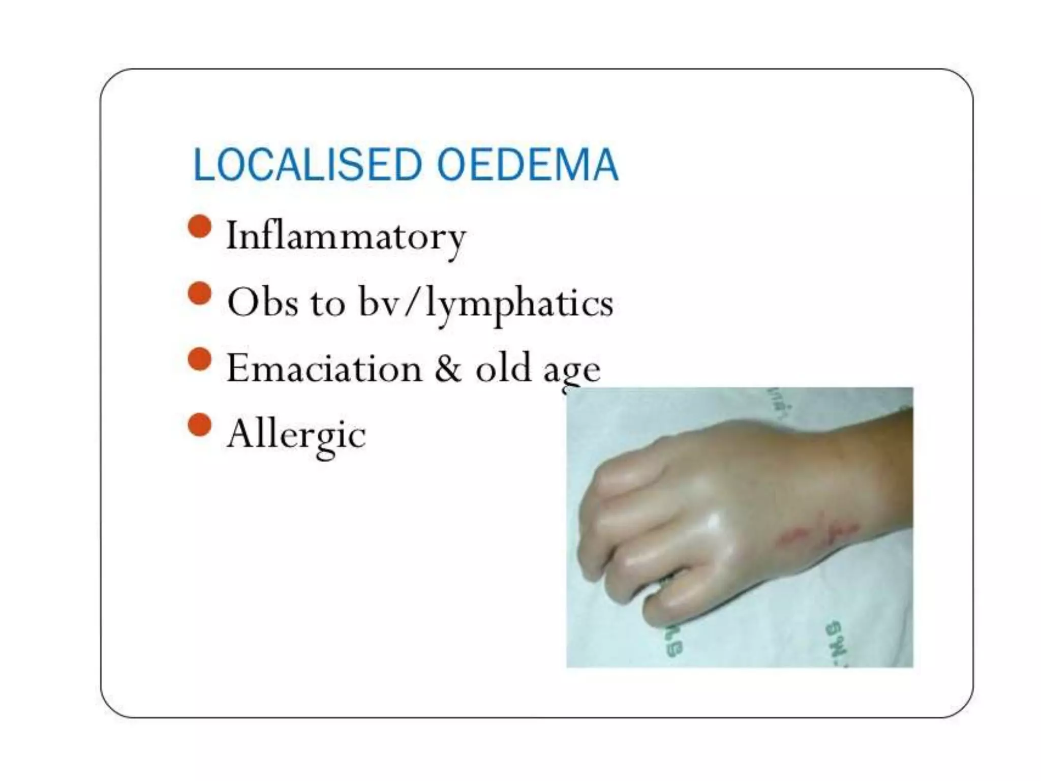 Edema | PPTX