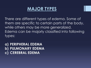 Edema | PPTX