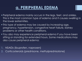 Edema | PPTX