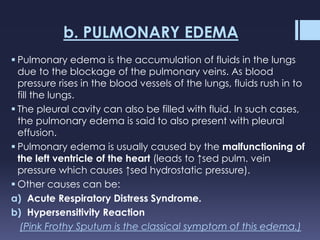 Edema | PPTX