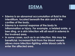 Edema | PPTX