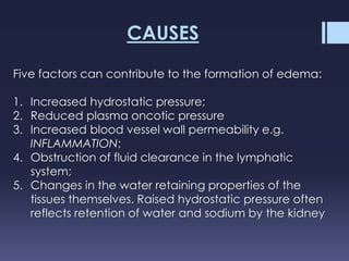 Edema | PPTX