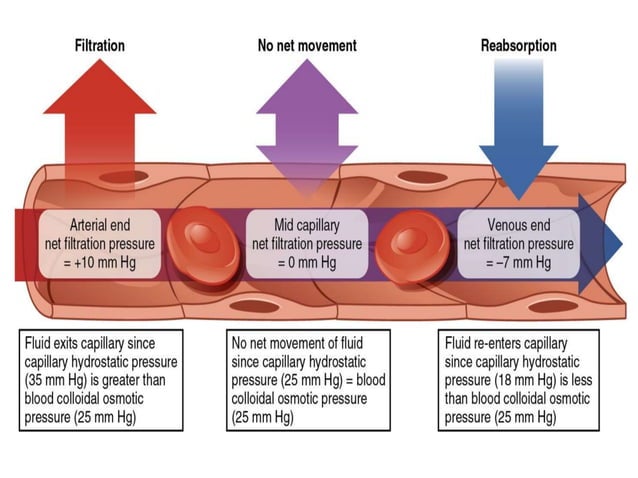 Edema | PPT