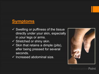Edema..ppt