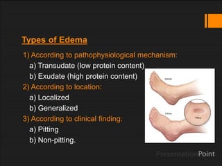 Edema..ppt