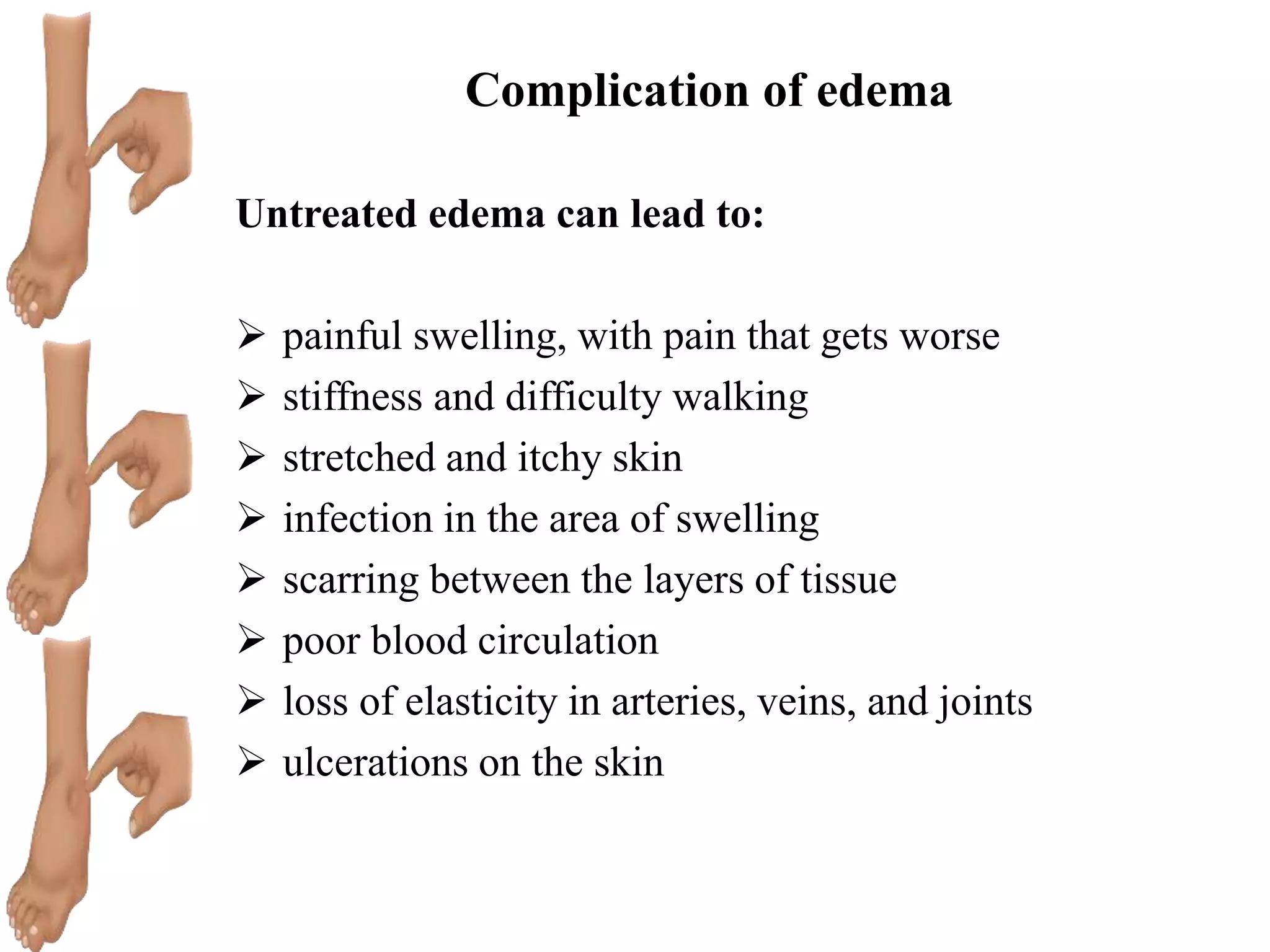 Edema | PPTX