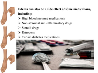 Edema | PPTX