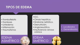 Edema | PDF