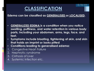 Edema | PPT