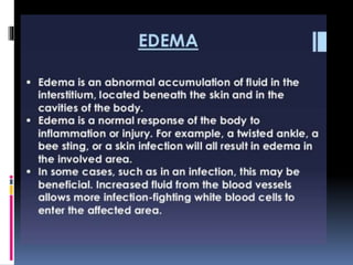 Edema | PPTX